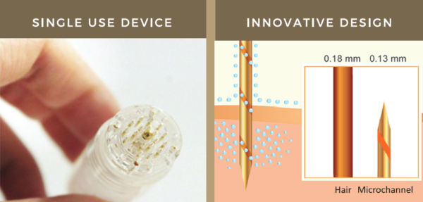 GOLD MICRO-INFUSION – Lesprit Medical Clinic