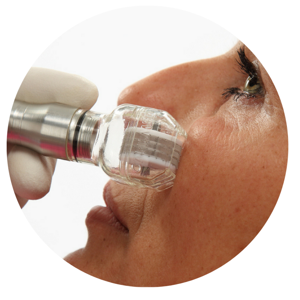 MIRAPEEL – Lesprit Medical Clinic